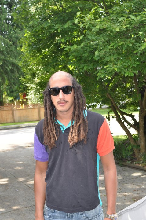 Bald rasta - Really funny pictures collection on picshag.com